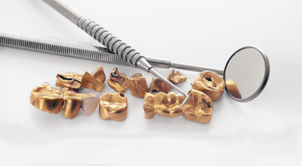 What is Dental Gold? - Garfield Refining