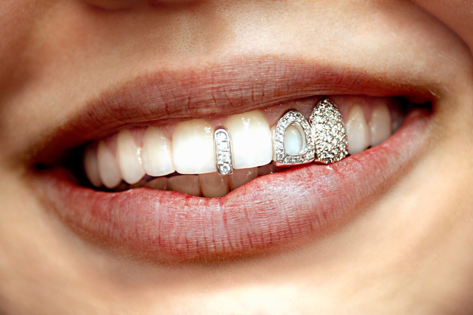 What to Know About Gold Tooth Jewelry - Garfield Refining